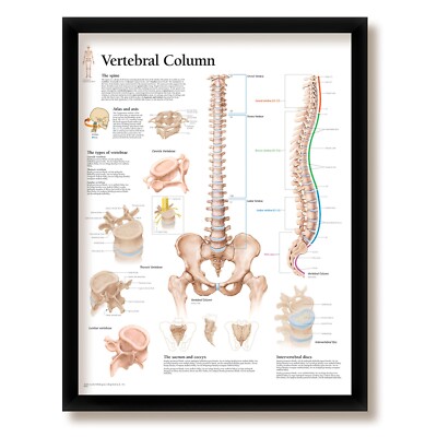 Vertebral Column Framed Medical Educational Poster & Frame, 22x28 Wall ...