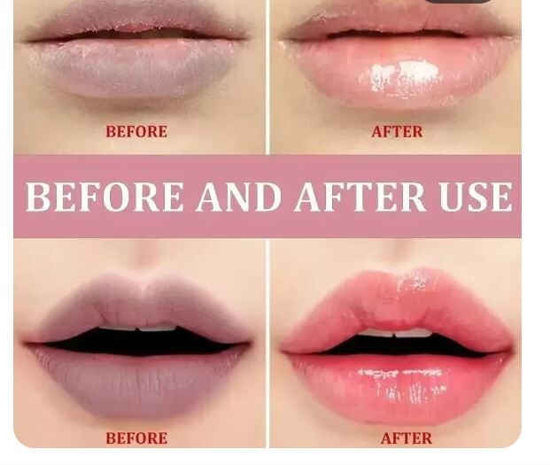 DARK LIPS LIGHTENING BALM PINK LIPS, FADE DARK SPOTS, EFFECTIVE ...