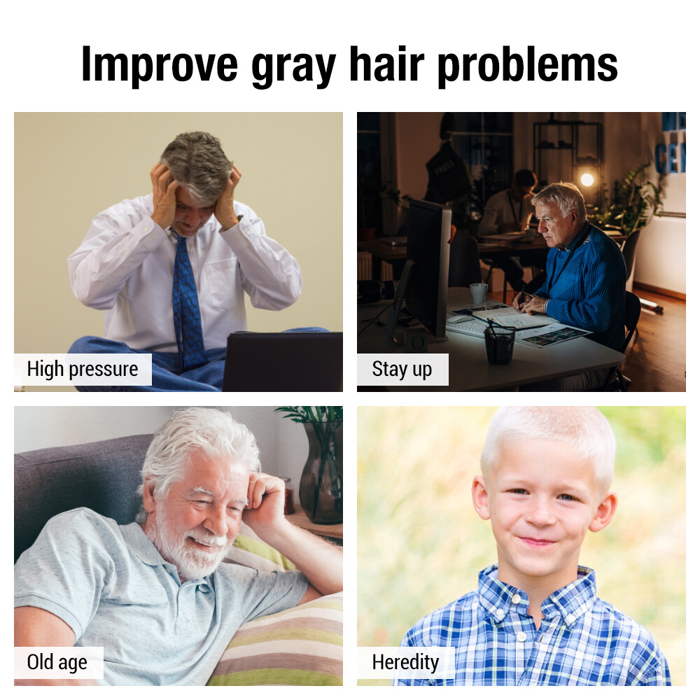 4x Gray Gone Soap - Gray Gone Bar Shampoo, Gray Hair Coverage Soap for ...