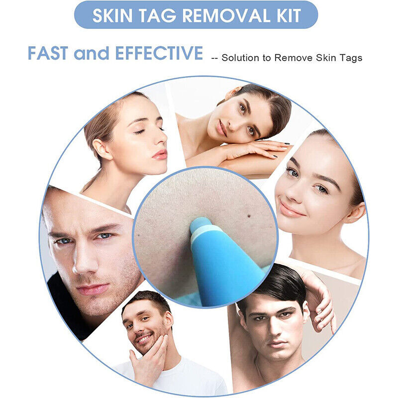 Auto Skin Tag Remover Bands Tool Loader Natural Spot Removal Cleaning ...