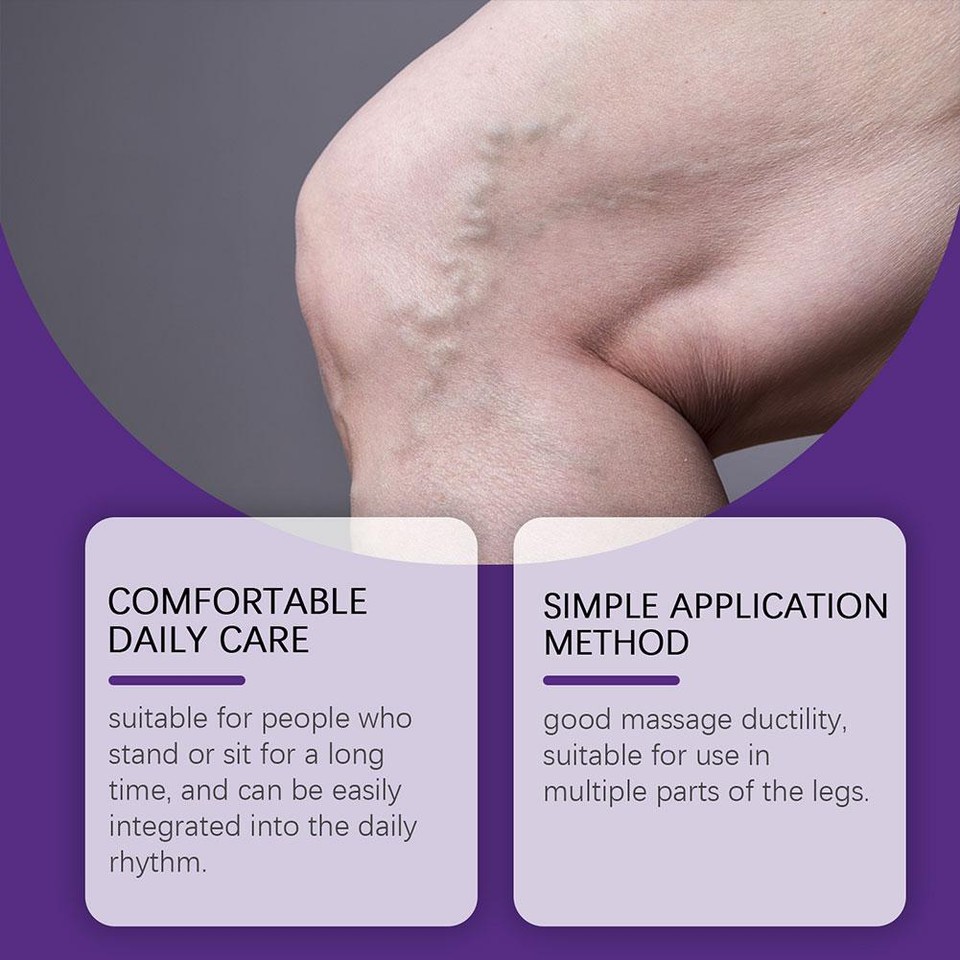 Varicose Vein Cream Vein Care Fading for Legs Veins Spider Veins Scars ...
