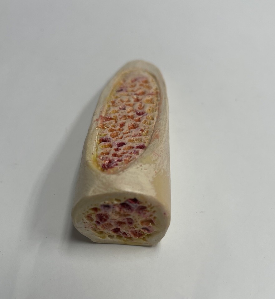 Vintage Bone Long Bone Infection Anatomical Pathology Model Section ...