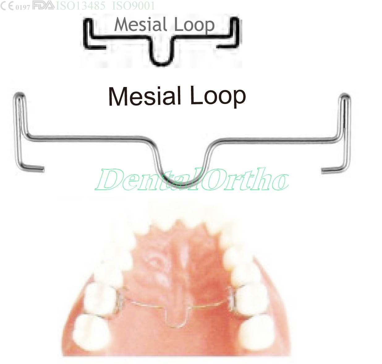 50 x Palatal Arch Bar Mesial Loop Dental Orthodontic Multi Size Mixed ...
