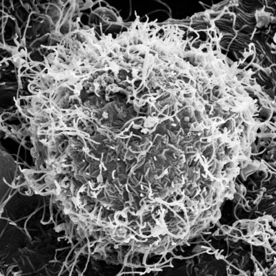 Ebola Virus Scanning Electron Microscope Micrograph Colorized Photo ...
