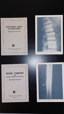 X-ray flash cards | eBay