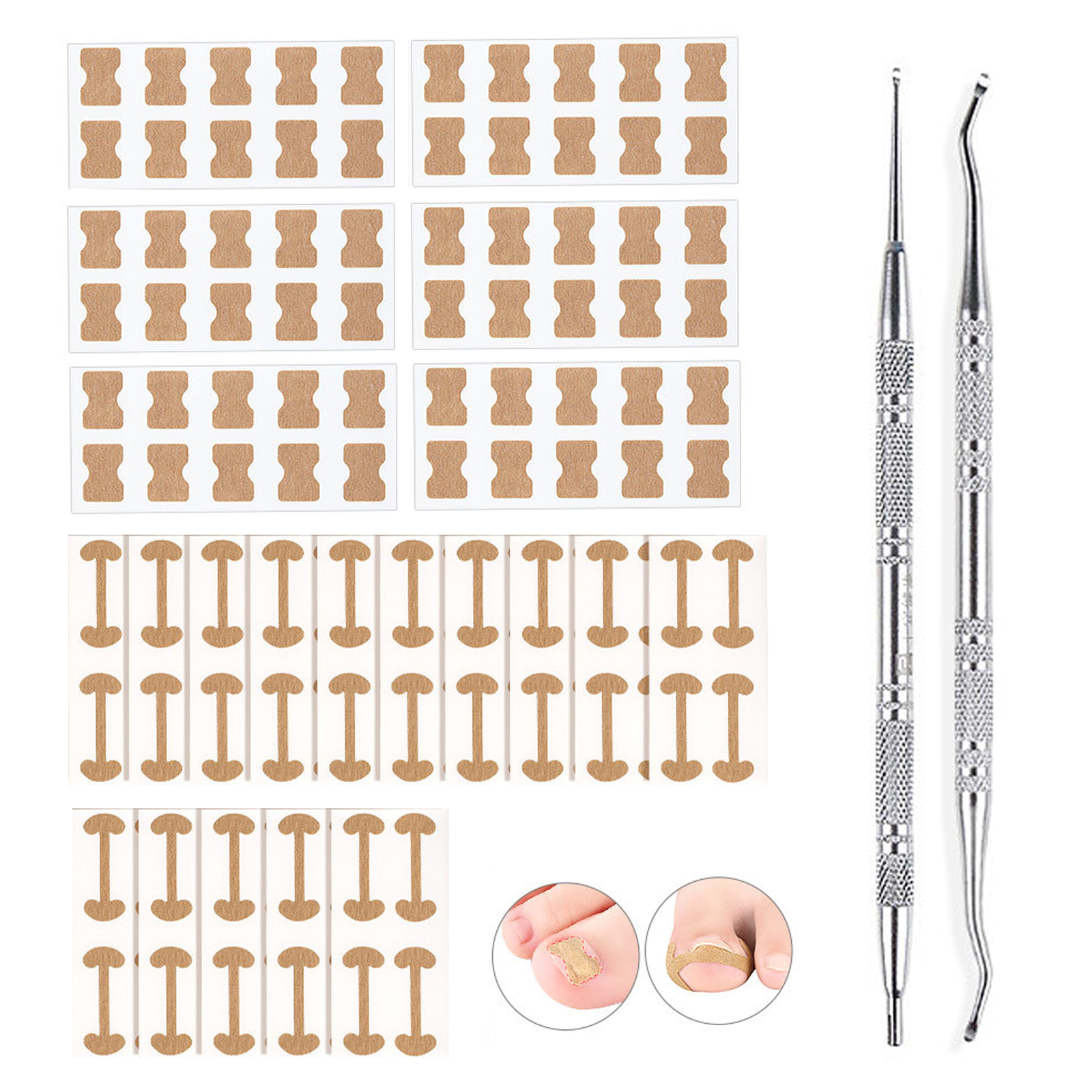 Painless Planing Tool Toe Stickers Home Ingrown Toenail Corrector ...