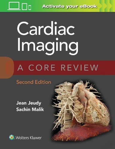 Sachin Basiq Malik Jean Jeu Cardiac Imaging: A Core Revi (Paperback ...