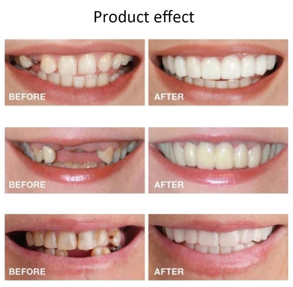 Cosmetic Silicone Fake Teeth Dental Facet Smile Perfect | eBay