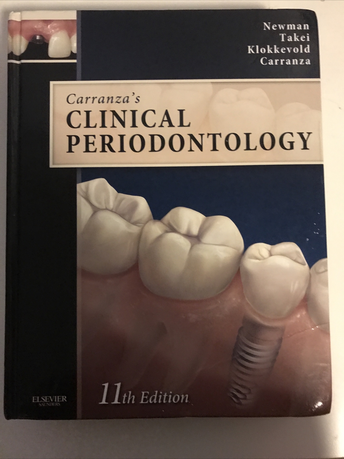 Carranza's Clinical Periodontology Expert Consult : Text with ...