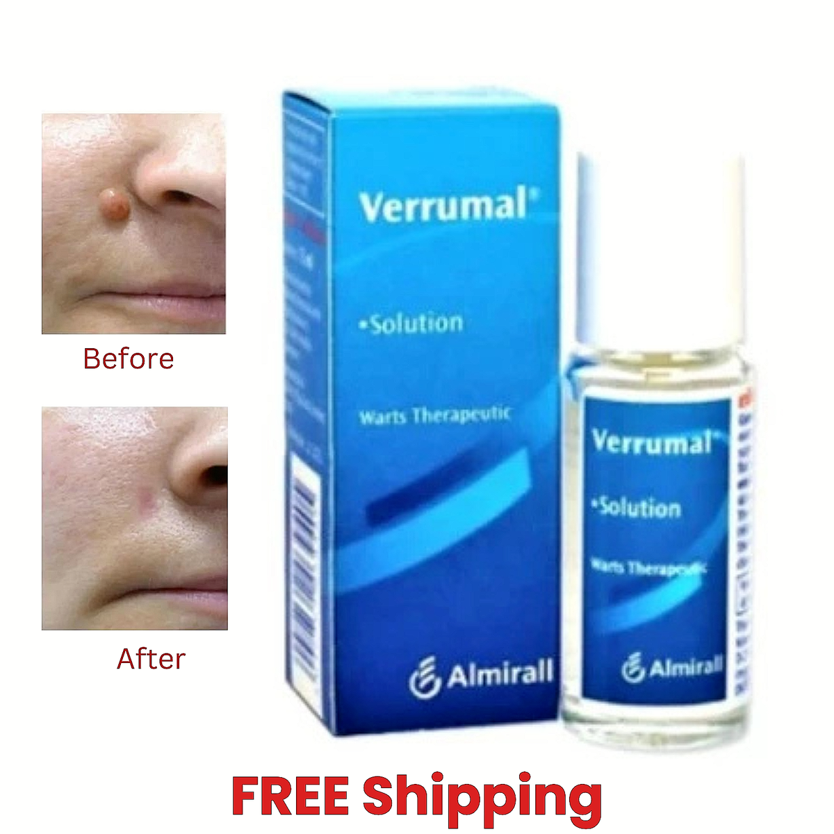 Verrumal