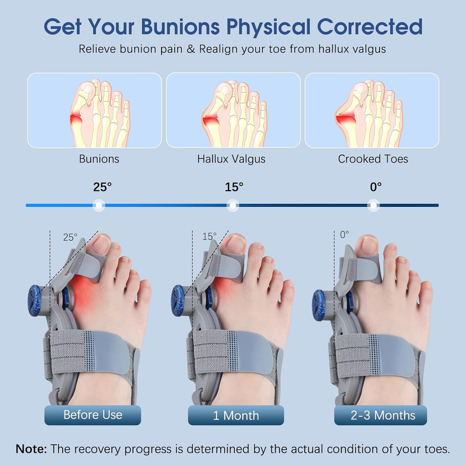 Bunion Corrector for Women & Men Big Toe: Adjustable Bunion Fix | eBay
