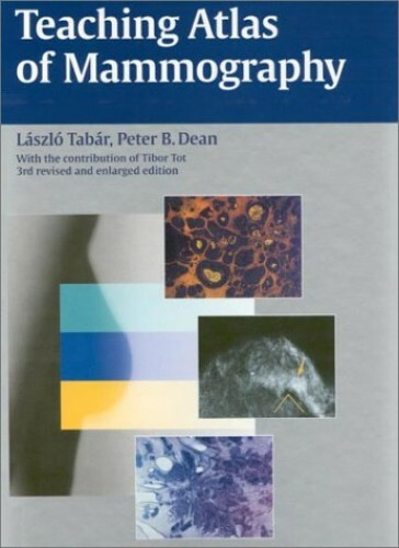 Teaching Atlas of Mammography by Peter B. Dean and Laszlo Tabar (2000 ...