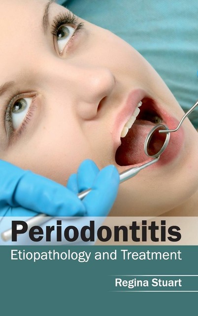 Periodontitis von Regina Stuart (2015, Gebundene Ausgabe) | Compra ...