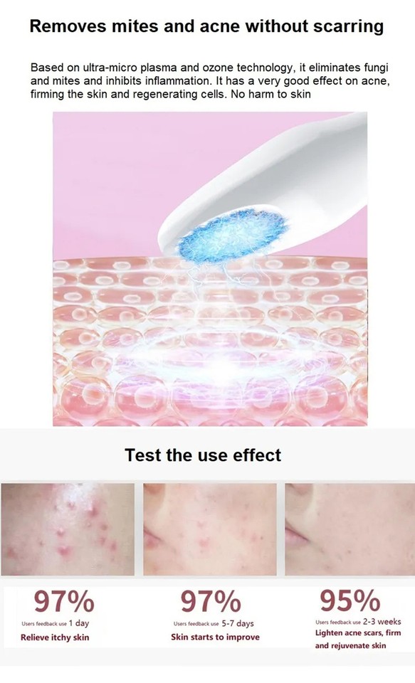 Ozone Plasma Pen Facial Skin Rejuvenation Acne Freckles Removal ...