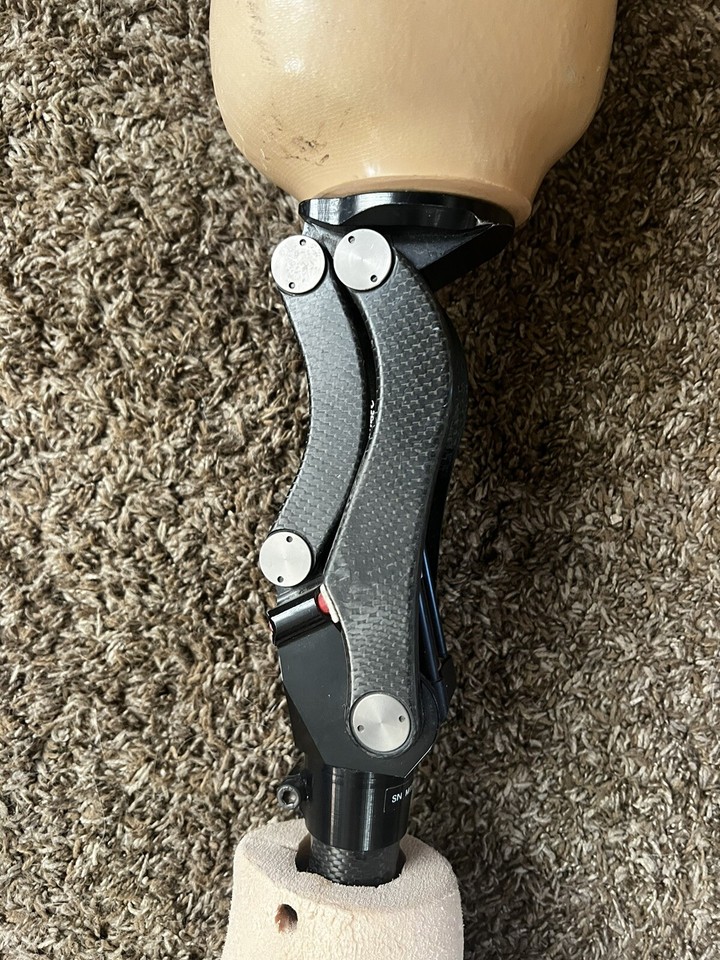 Endolite Prosthetic Above Knee Limb With Insert - Swing Phase Control ...