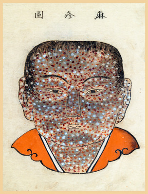 Designer decoration Poster.Smallpox.Japan.Home room wall art Decor ...