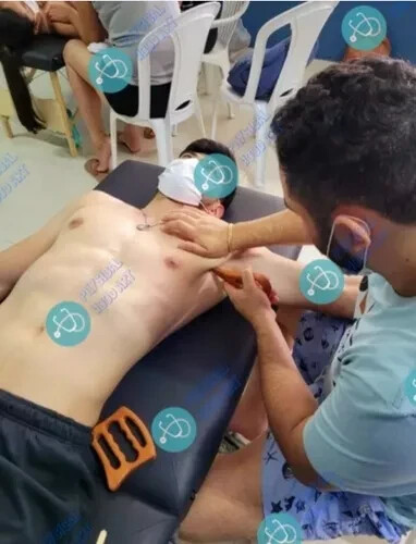 Punch Tool Massage Myofascial Release Physical Therapy Lastm Gua Sha ...