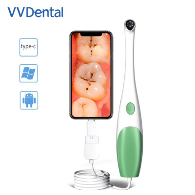 Dental Oral Camera 1080p HD Intraoral Endoscope Adjustable 6 LED Light ...