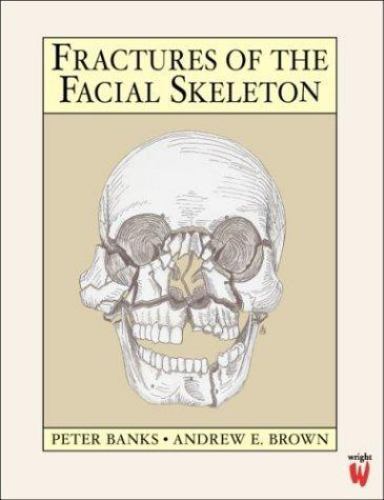 Fractures of the Facial Skeleton by Peter Banks and Andrew Brown (2001 ...