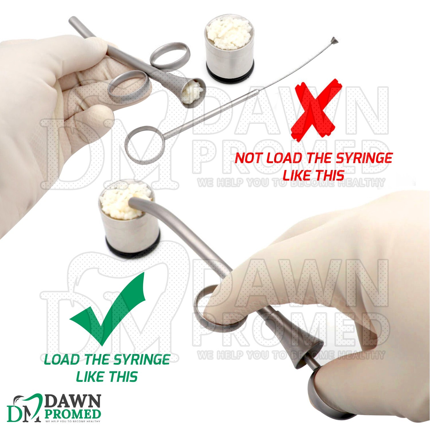 12 Pcs Dental Bone Graft Implant Syringe 6mm Set Cylindrical Shaft ...