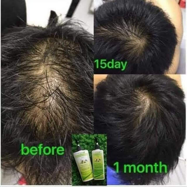 Set 4YL Thai Herbal Bergamot Shampoo 400 ml + Hair Conditioner 400ml | eBay