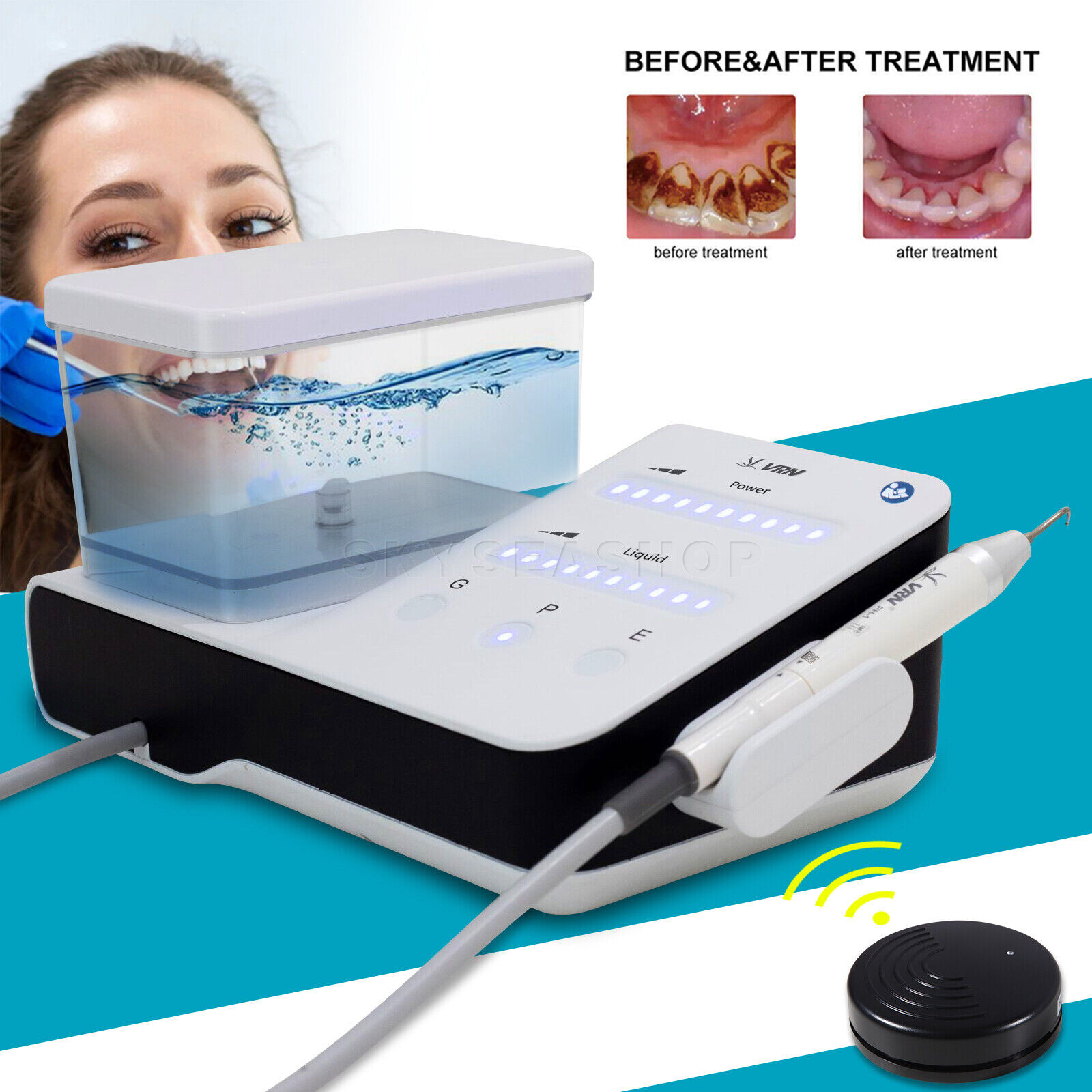 LED Dental Ultrasonic Piezo Scaler Detachable Ultrasound Unit fits EMS ...