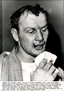 LG899 1967 AP Wire Photo ROGER ROUSE SUFFERS DEEP CUT ON MOUTH Dick ...