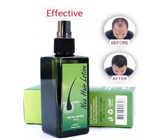 Neo Hair Lotion Hair Root HAIR BEARD SIDEBURNS LONGER Herbs 100%~120ml ...