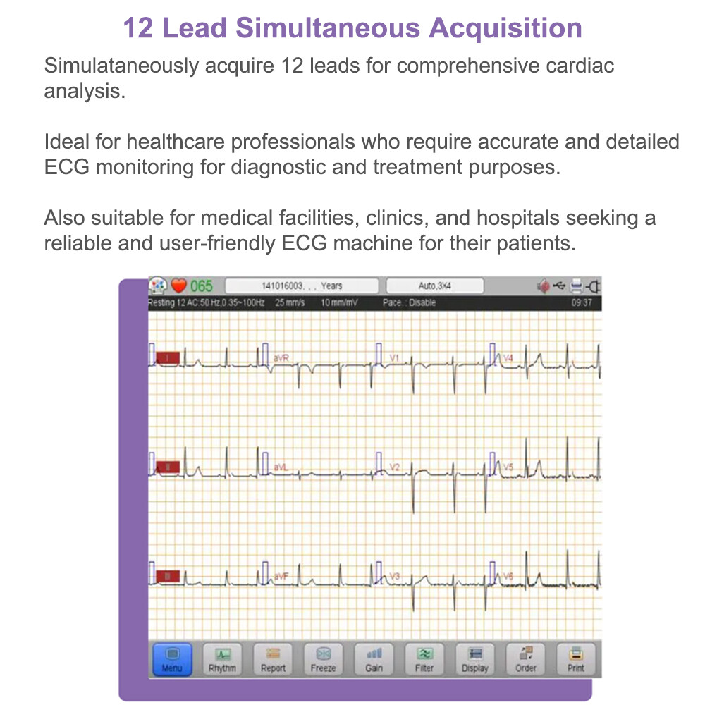 Biocare iE6 12 lead 6 channel ECG Machine Touchscreen with ...