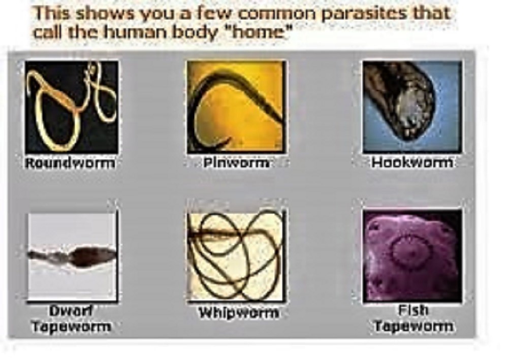 The Life Tree Purify Intestinal Support Parasite Cleanse Detox 60 ...