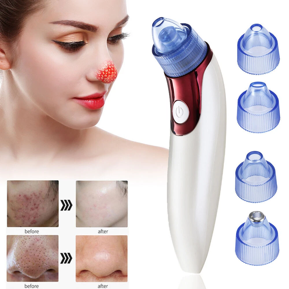 Zit Suction Tool