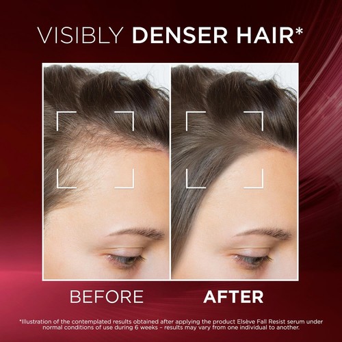 L'Oréal Paris Elvive Fall Resist Hair Serum 1.5% Aminexil Anti Hair ...