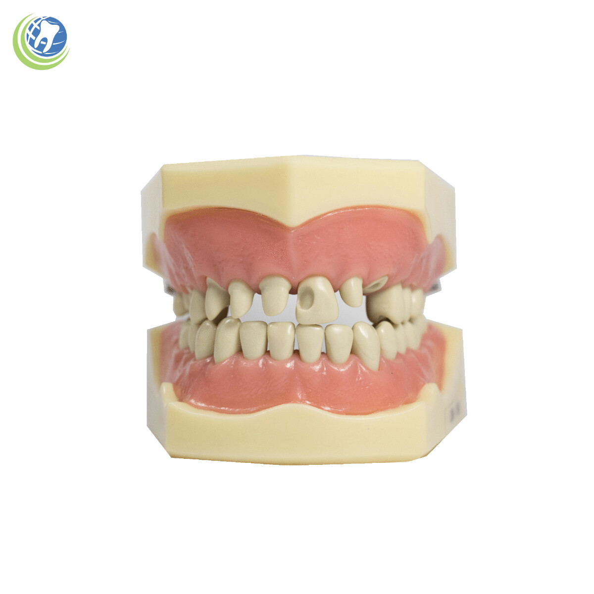 Dental Typodont Model 860R Prep Teeth NBDE NERB ADEX G V Black ...