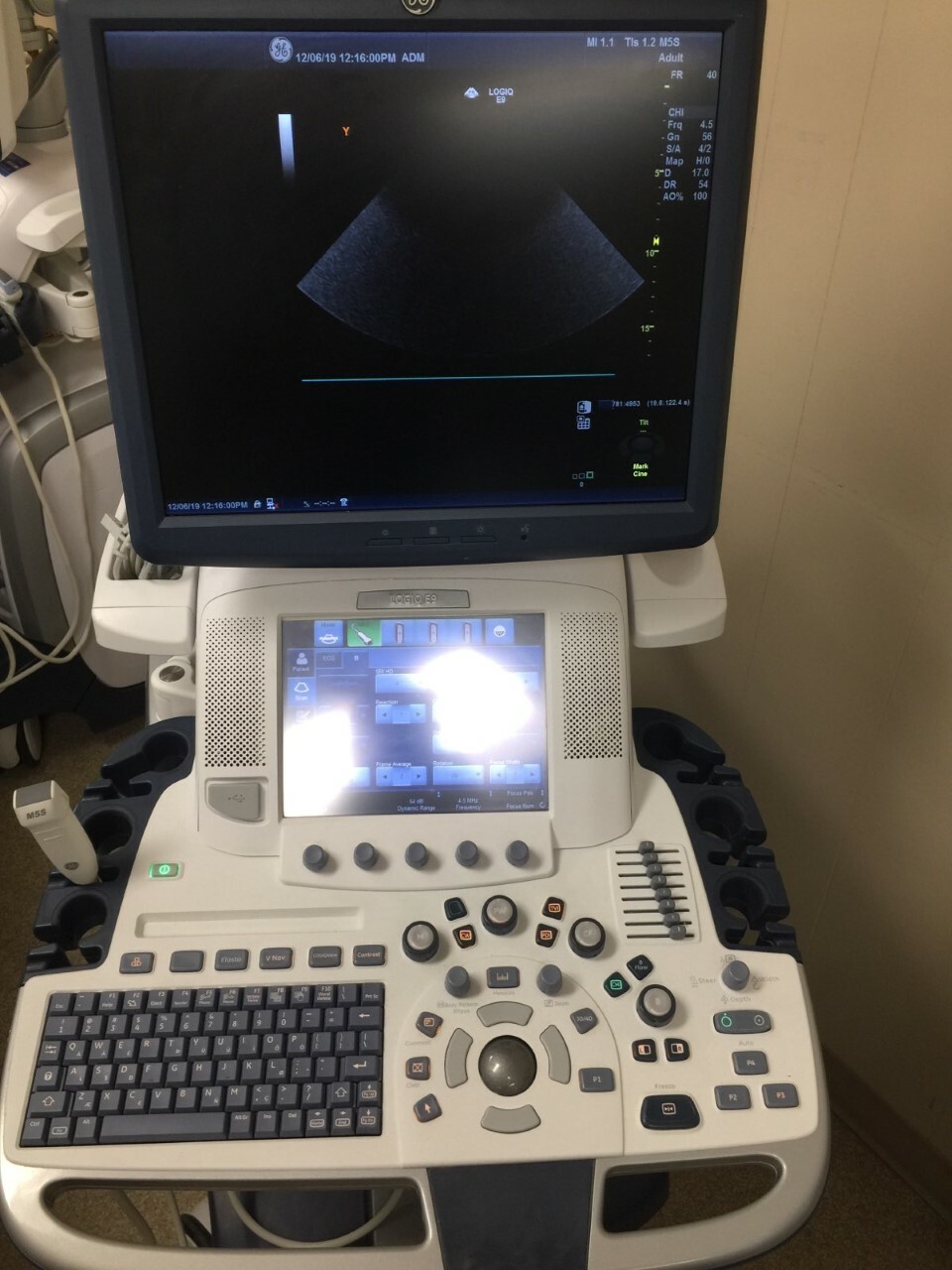 GE Logiq E9 R6 Shared Service Ultrasound System. | eBay