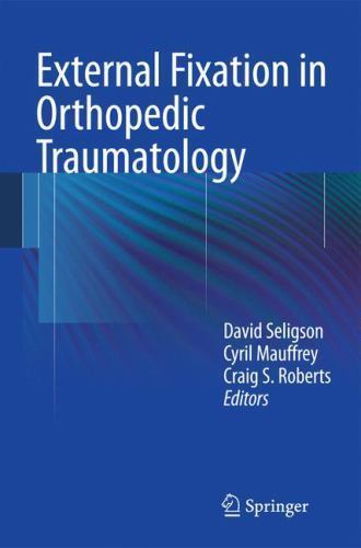 External Fixation in Orthopedic Traumatology by David Seligson (2011 ...