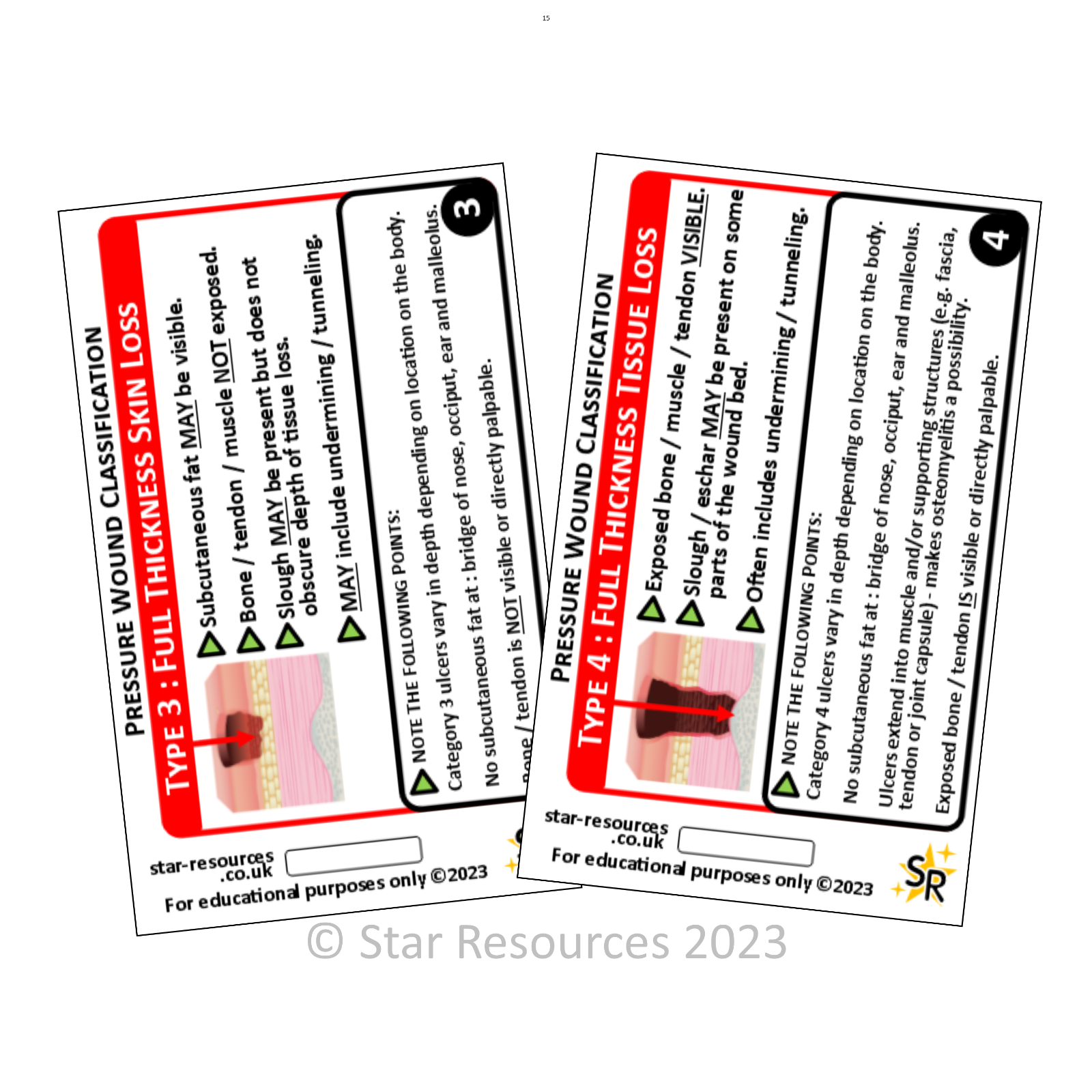 Pressure Wound Classification ID Badge FlashCards Student Paramedics ...