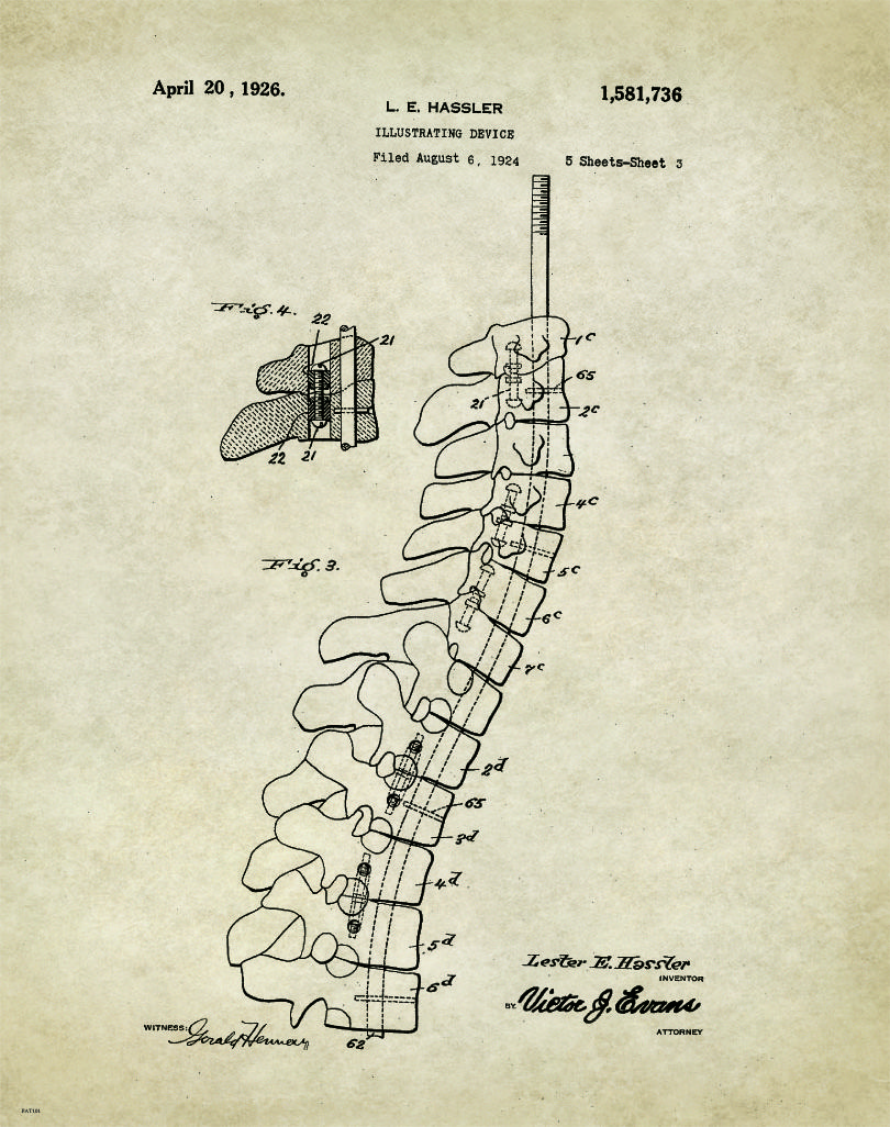 Chiropractic Graphics New Patient Special | Chiropractor Wooster OH
