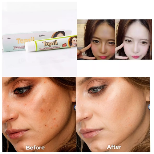 Dr. Veda's Topsil Anti Aging & Whitening Beauty Cream Ayurvedic 20g | eBay