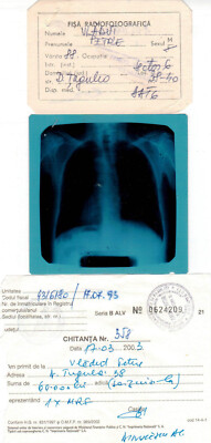 Romania, 2002, Vintage Medical Radiographic / X-RAY File | eBay