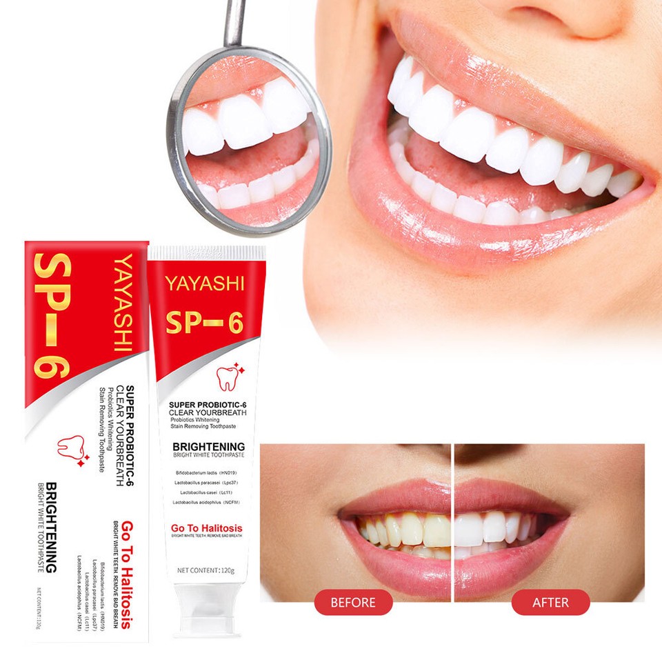 2025 SP-6 Probiotic Toothpaste,Sp-6 Toothpaste Whitening Quick White ...