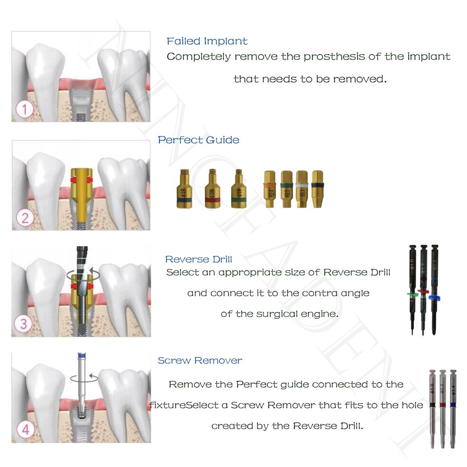 Neobiotech SR Broken Screw Removal Kit,Implant Handpiece 20:1 Surgical ...