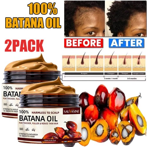 2x Batana Oil Cream For Hair Growth,Natural Botana Oil Cream Hair Loss ...