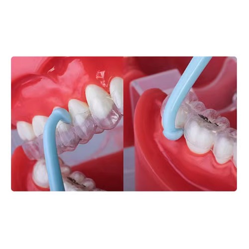 J&J Ortho Dental Orthodontic Aligner Remover Hook Retainer Retriever ...