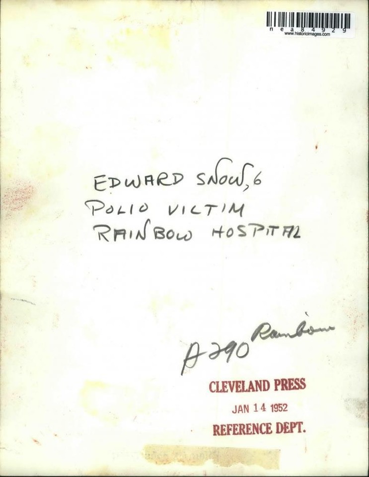 1952 Press Photo Polio Patient Edward Snow At Rainbow Hospital ...