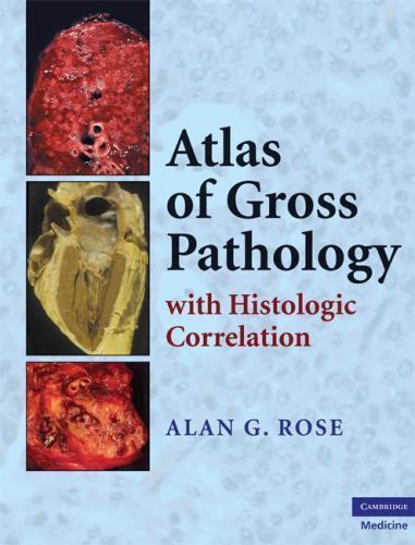 Atlas of Gross Pathology : With Histologic Correlation by Alan G. Rose ...