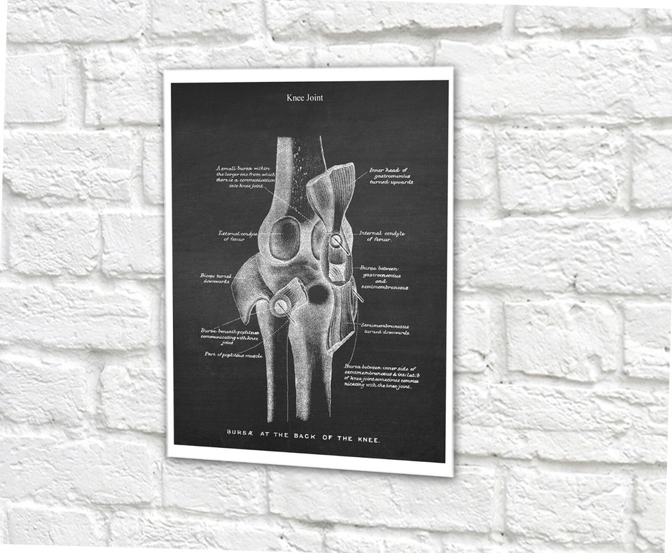 Anatomy Decor Poster set of 3 Unframed Posters Hip Knee Ankle Joints ...