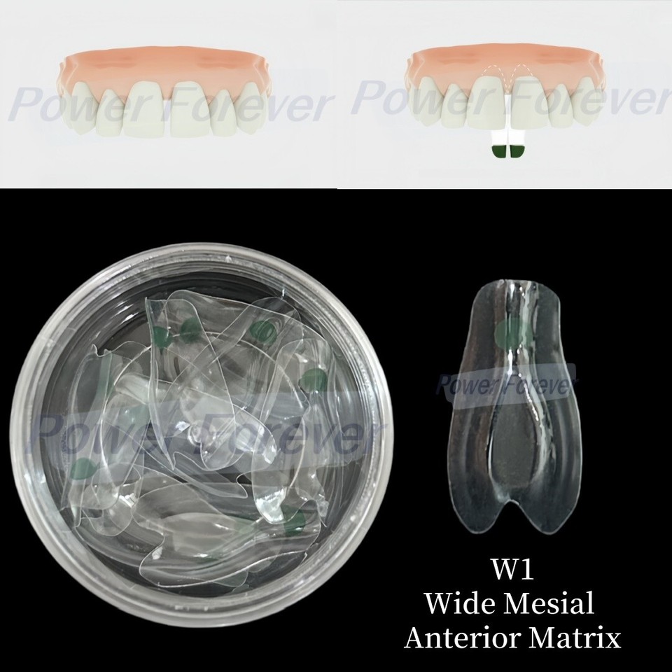 Dental Clear Matrix Anterior Posterior Restorative BT Bow Matrices Fit ...