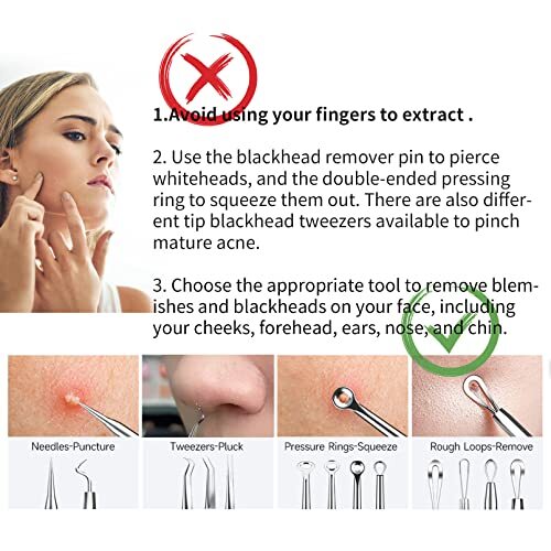 2024 Professional Pimple Popper Tool Kit - 22 PCS Blackhead Remover ...