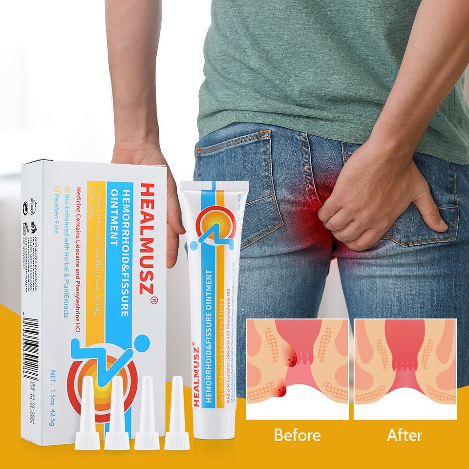 2~haemorrhoids Treatment Cream Hemorrhoid Piles Anal Fissure Prolapse