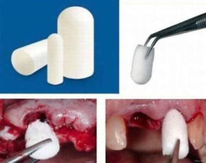 10 x New Colo Plug Sterile Collagen Sponge 8 X 20 mm in Dental ...